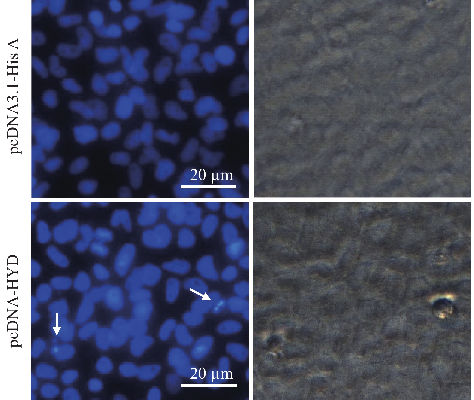 Cloning and subcellular localization of HYD gene from Nocardia seriolae