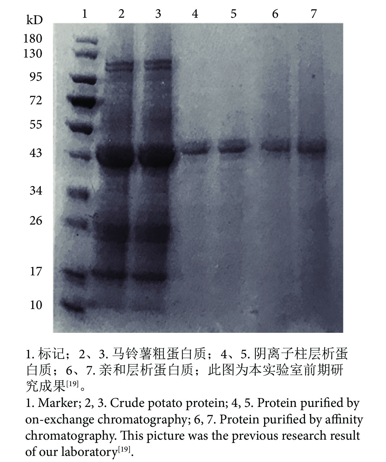 适用鱼油加工的Patatin酯酶固定化及其特性研究